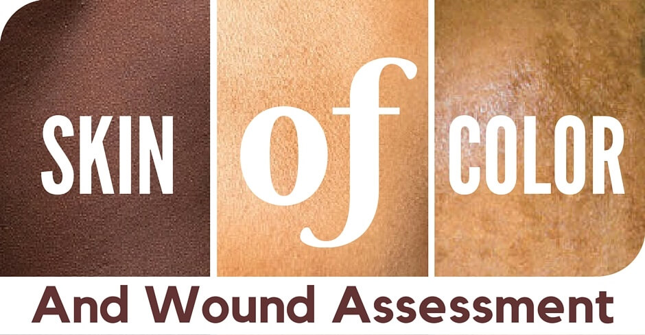 Wound Assessment: Skin of Many Colors - WCEI - Blog WCEI – Blog