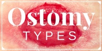 Let's Talk Ostomy Types | WCEI WCEI