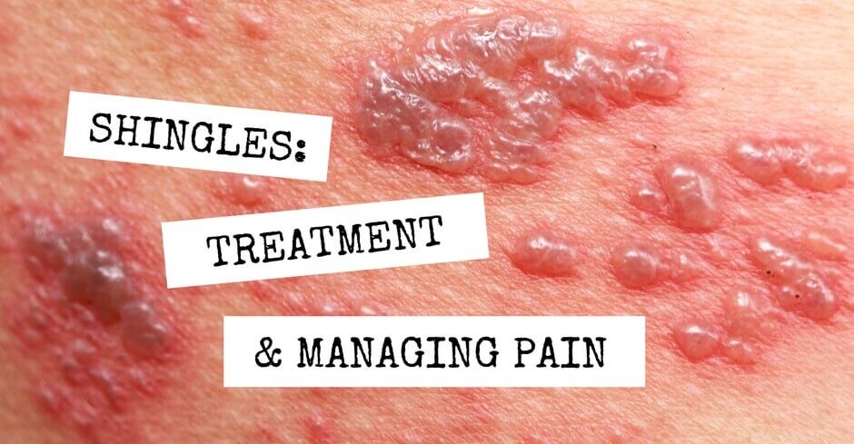 Shingles: Treatment and Managing Pain - WCEI - Blog WCEI – Blog