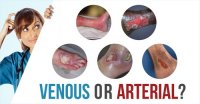Venous, Arterial or Mixed Ulcer...How Do I Know For Sure? | WCEI