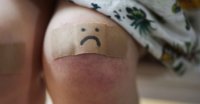 Denuded Wounds & Tragic Open Wounds: Types Defined | WCEI