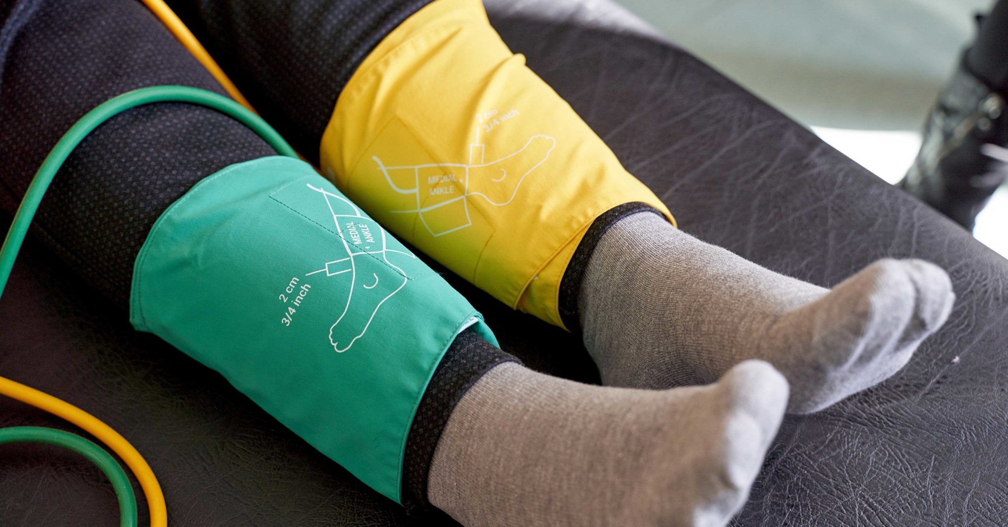 An Overview of Peripheral Artery Disease (PAD) and Wound Care | WCEI