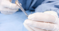 3 Types of Wound Closure and What They Mean WCEI