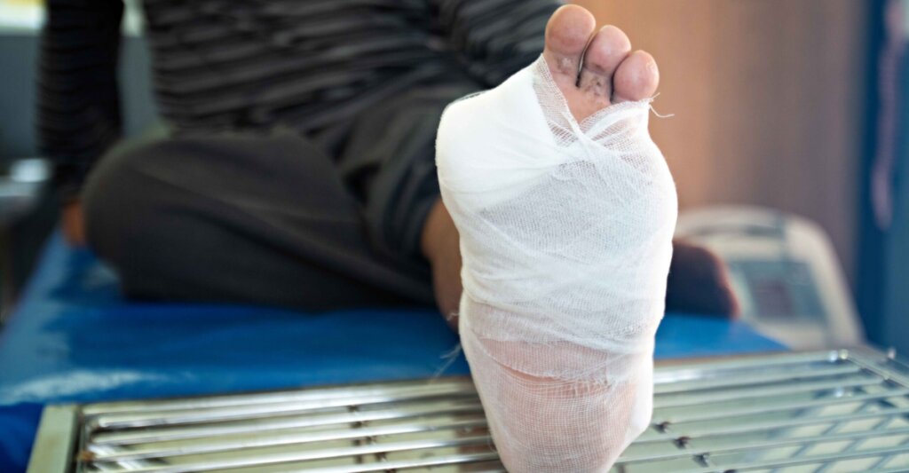 Diabetic Foot Ulcer Classifications: Wagner Scale & the UT System WCEI