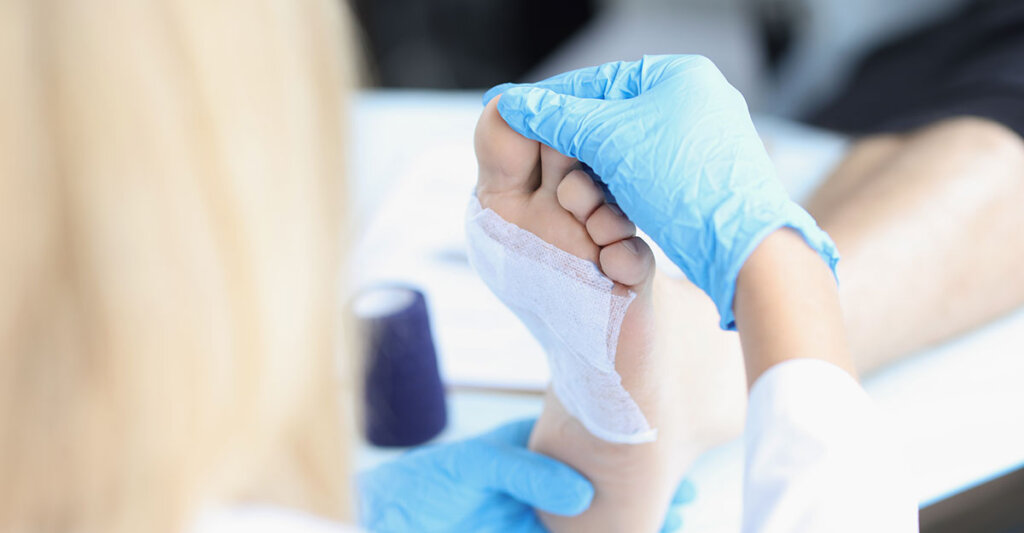 Alginate Dressing: Benefits, Uses, and Best Practices | WCEI WCEI