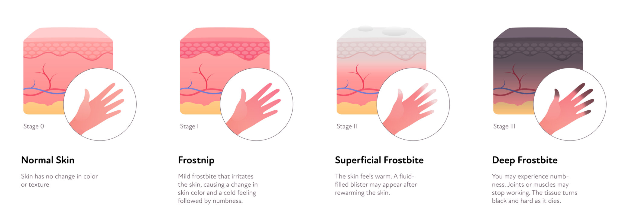 Emergency Wound Care: Managing Wounds in Disasters | WCEI WCEI