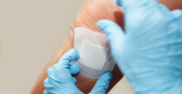 Wound VAC Basics Every Clinician Should Know | WCEI WCEI